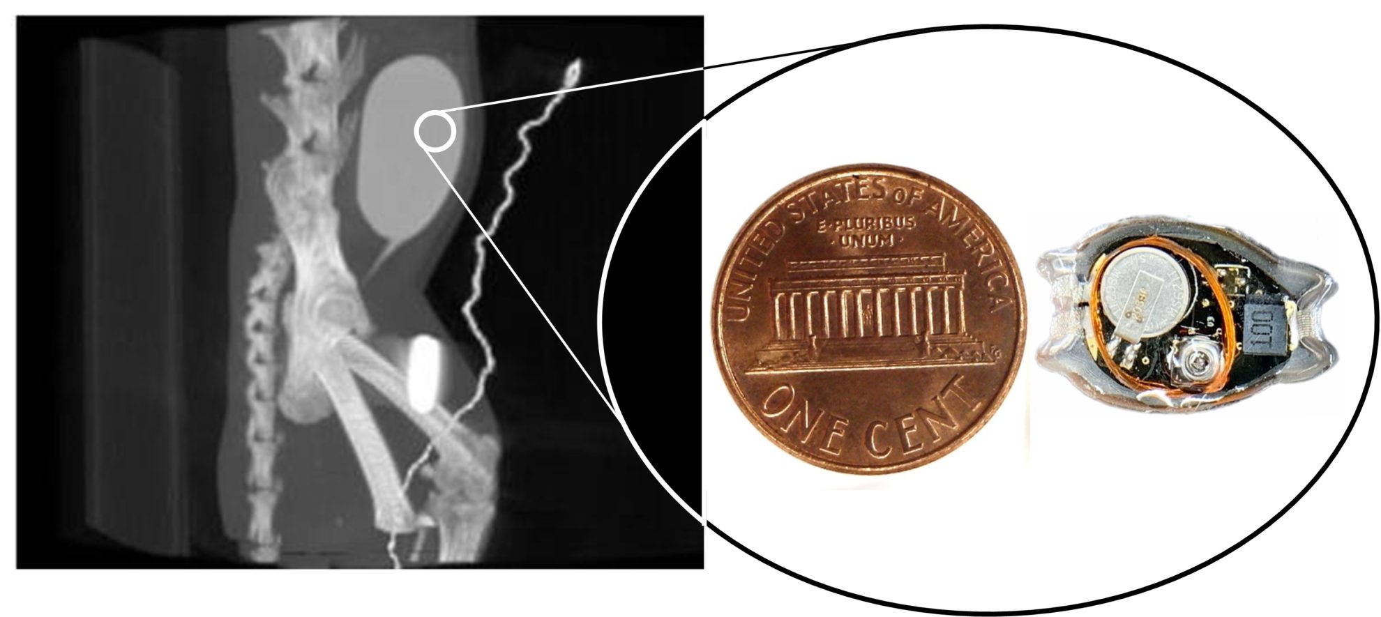 New Article “Wireless and Catheter-Free Bladder Pressure and Volume ...